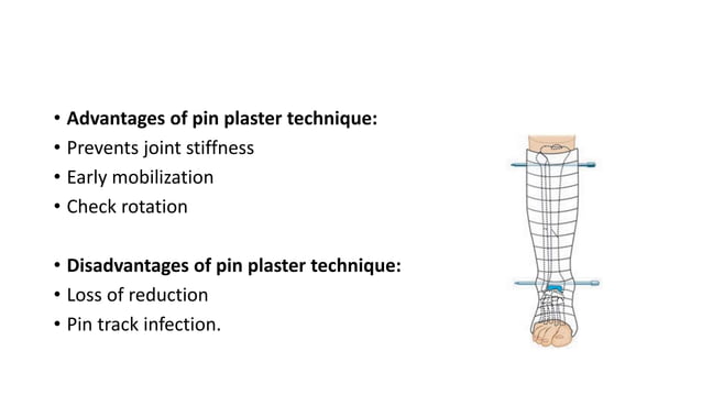 pop and bone cement orthopaedics ppt.pptx