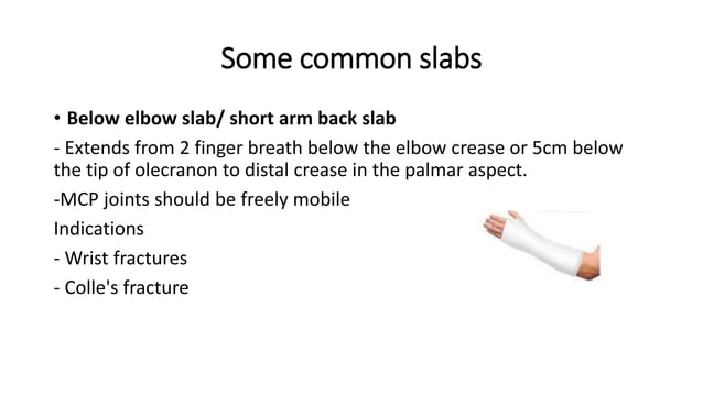 pop and bone cement orthopaedics ppt.pptx