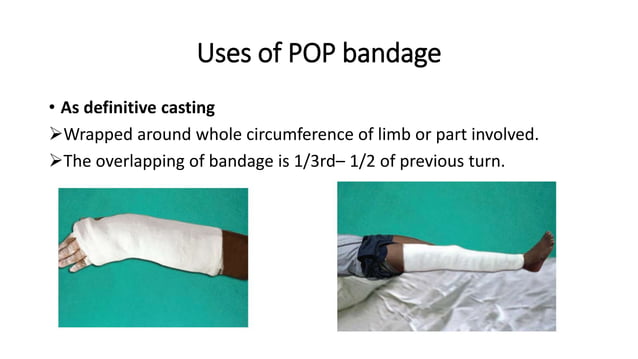 pop and bone cement orthopaedics ppt.pptx