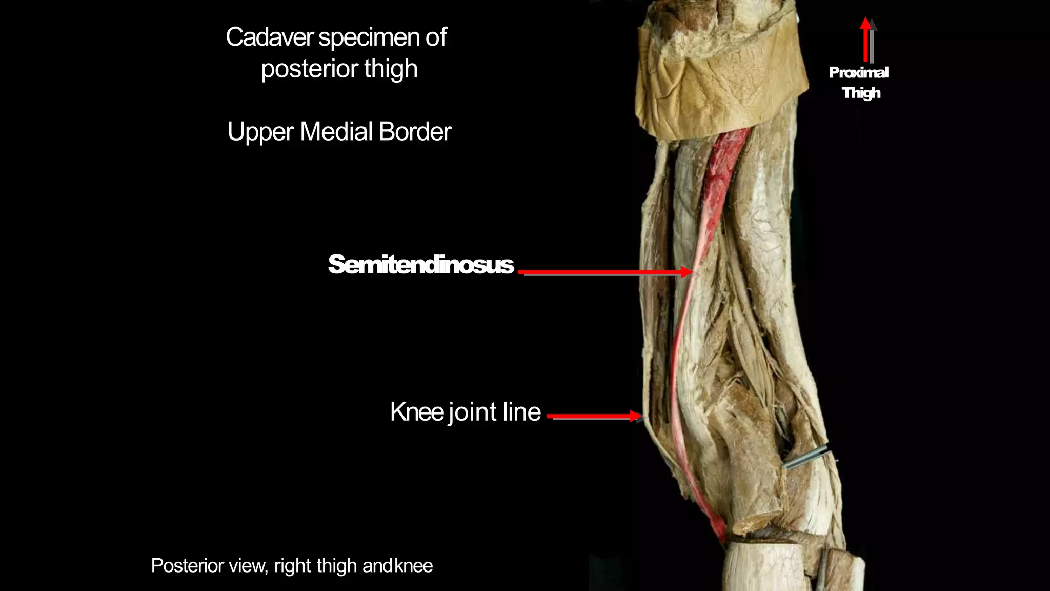 Popliteal fossa Anatomy - Dr. Rahul Singh Thakur | PPTX