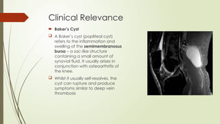 POPLITEAL FOSSA/knee fossa/ regional anatomy | PPTX