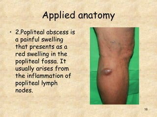 Popliteal fossa for Mmed and Medical students | PPT