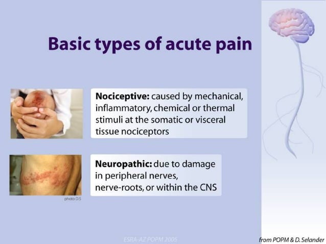PostOp Pain Management | PPT | Physical Therapy | Wellness