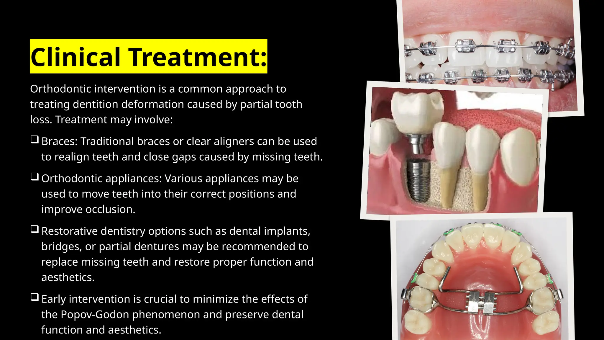 Popov-Godon phenomenon presentation for dentestry | PPTX