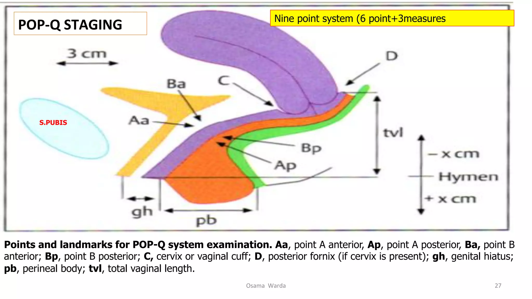 Pop (post graduate). prof. osama warda | PDF