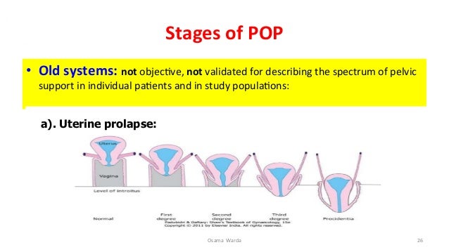 Pop (post graduate). prof. osama warda