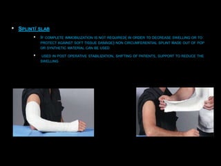 basics of plaster and slabs | PPTX