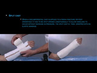 basics of plaster and slabs | PPTX