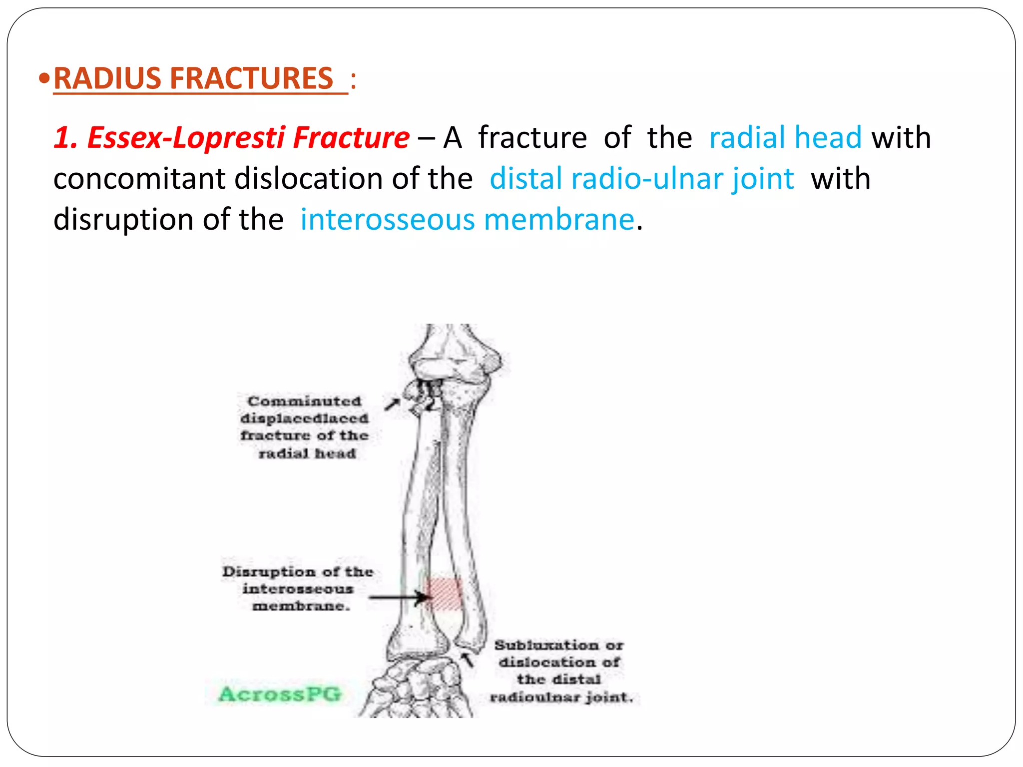 Fracture types - Plaster Of Paris tecniques and Complications | PPTX
