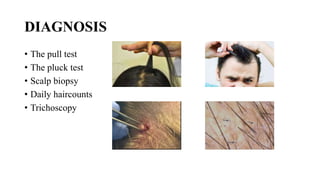 Popular science topic on hair loss by Siddhartha Das | PPTX | Hair Care ...