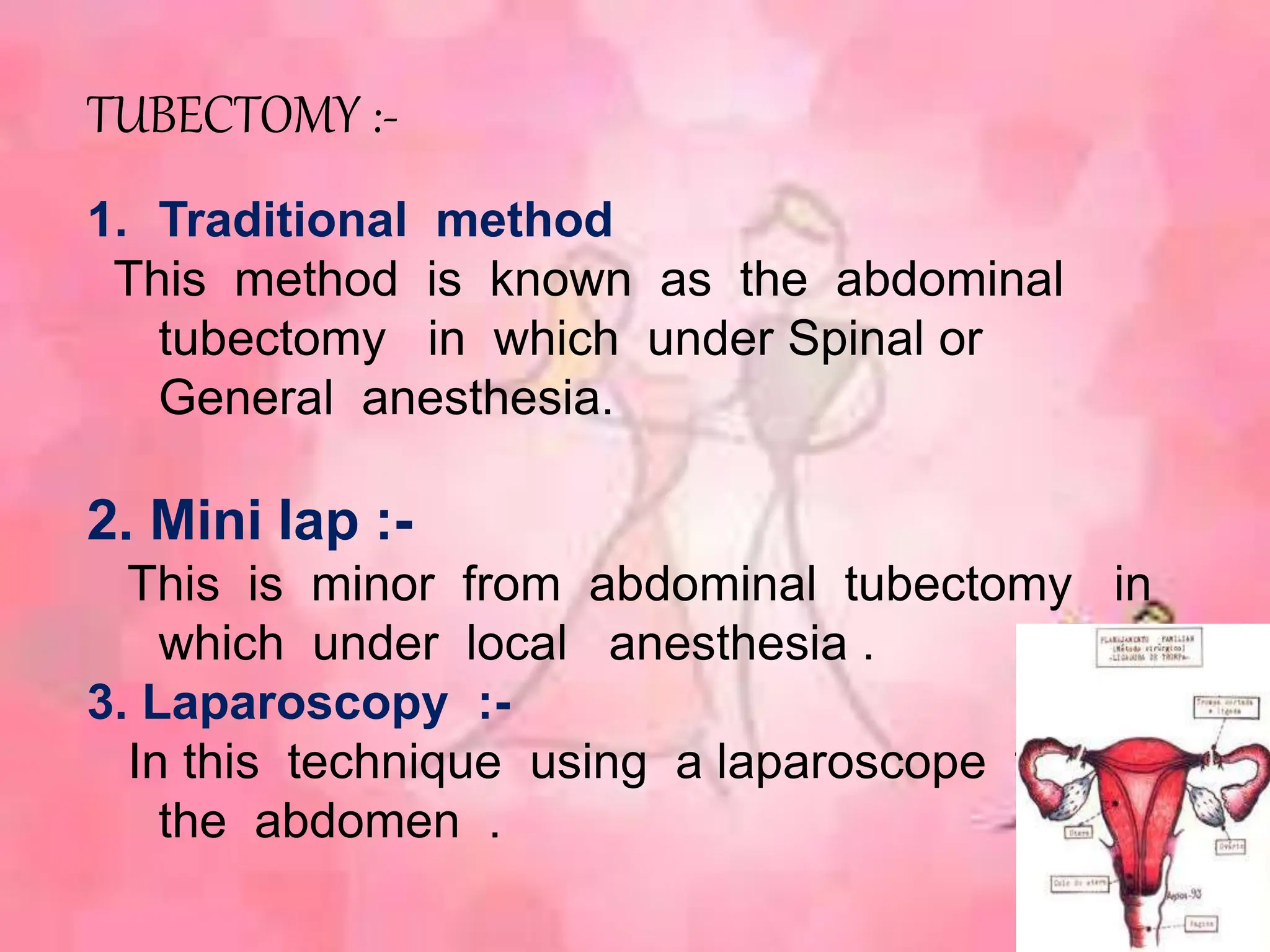 POPULATION PLANNING + family planning+ population control.pptx
