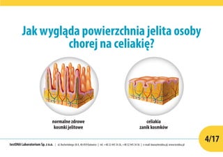Poradnik kiedy-gluten-szkodzi-celiakia | PDF
