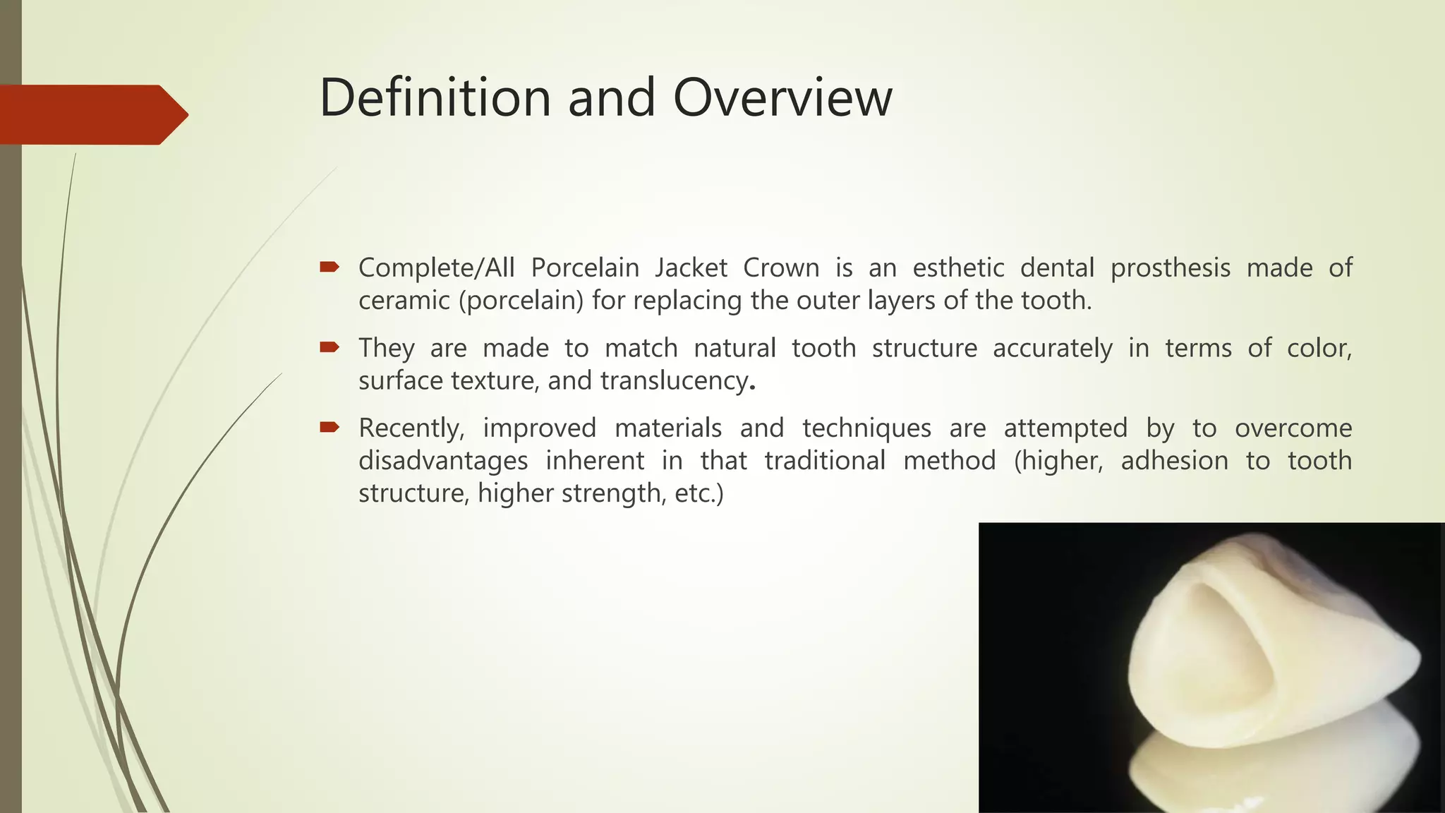 Porcelain jacket crown | PPTX