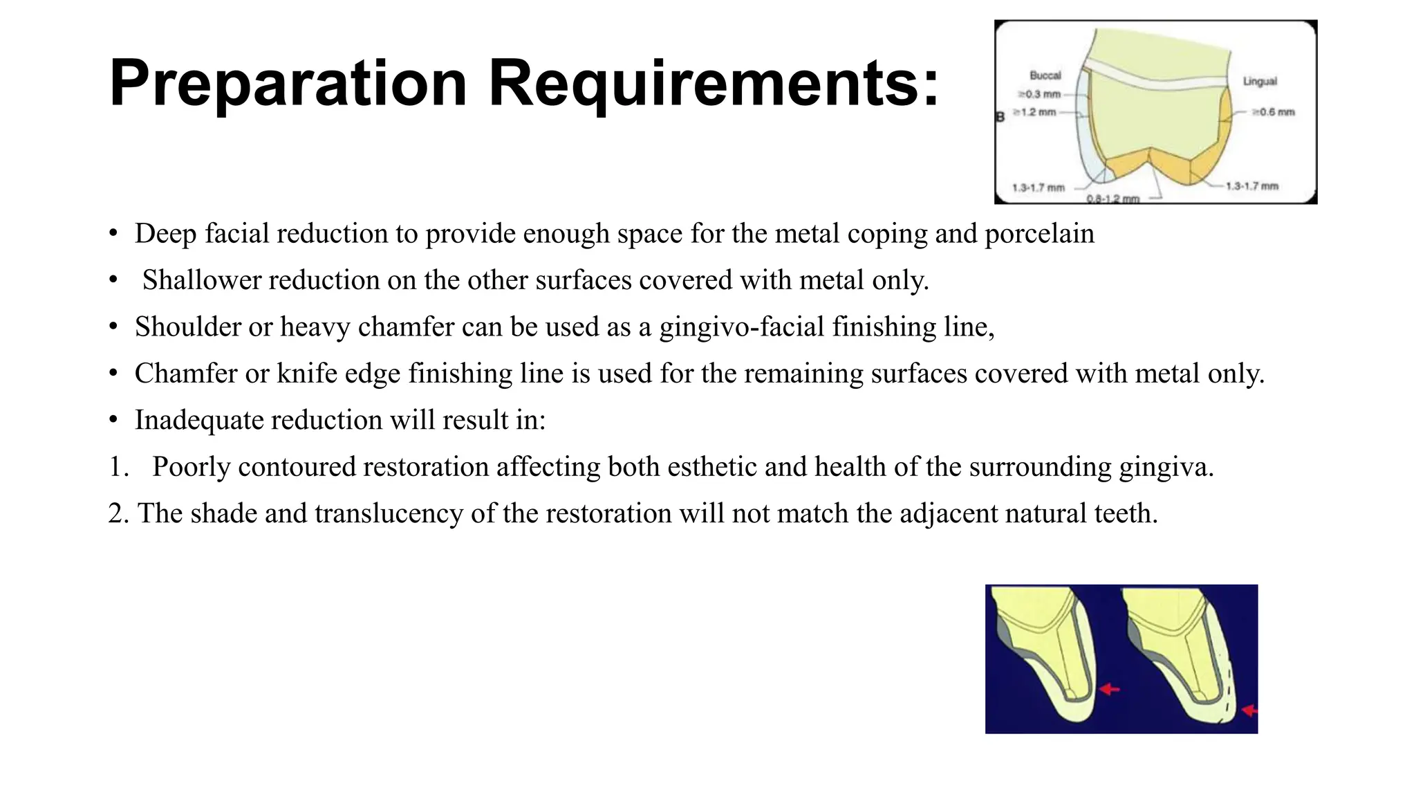 Porcelain Fused to Metal Crown in prosthodontics.pptx