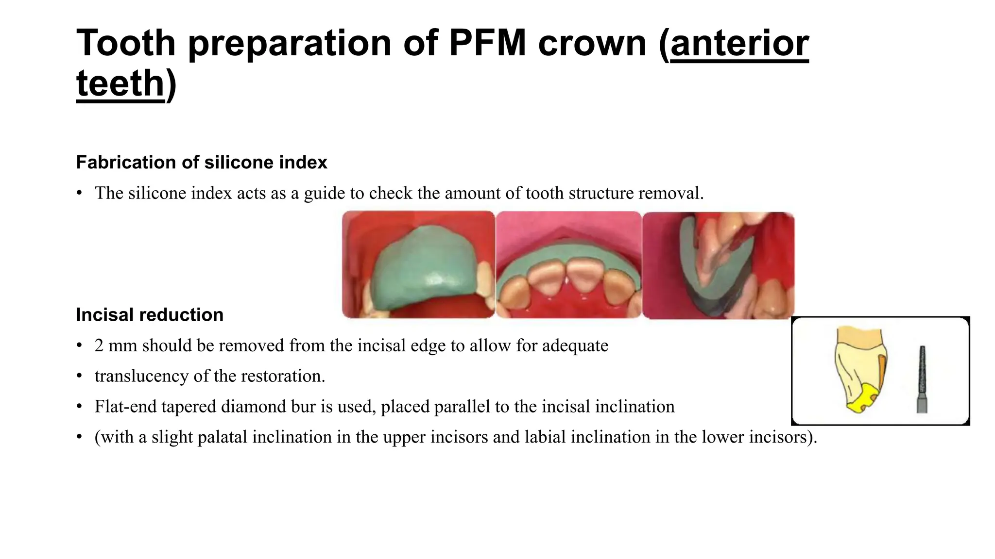Porcelain Fused to Metal Crown in prosthodontics.pptx