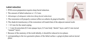 Porcelain Fused to Metal Crown in prosthodontics.pptx