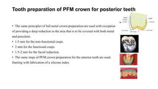 Porcelain Fused to Metal Crown in prosthodontics.pptx