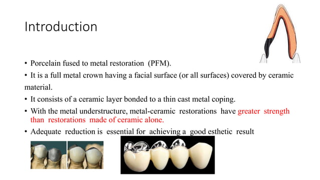 Porcelain Fused to Metal Crown in prosthodontics.pptx | Oral care ...