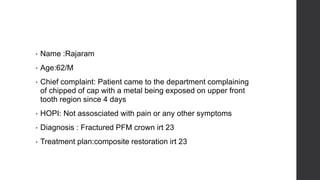 PORCELAIN REPAIR (1).pptx