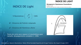 Porcentaje de neumotorax | PPTX