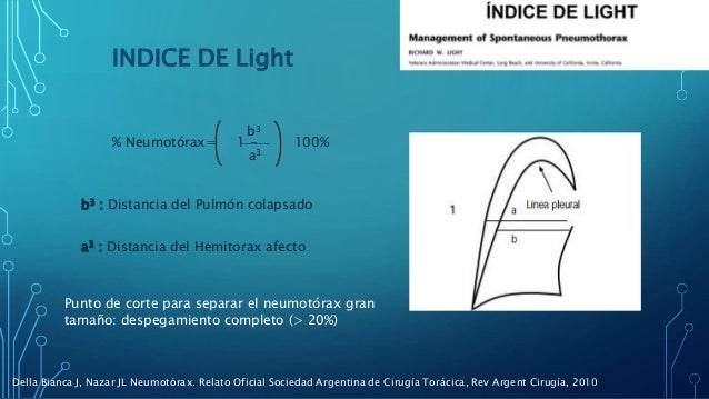 Porcentaje de neumotorax