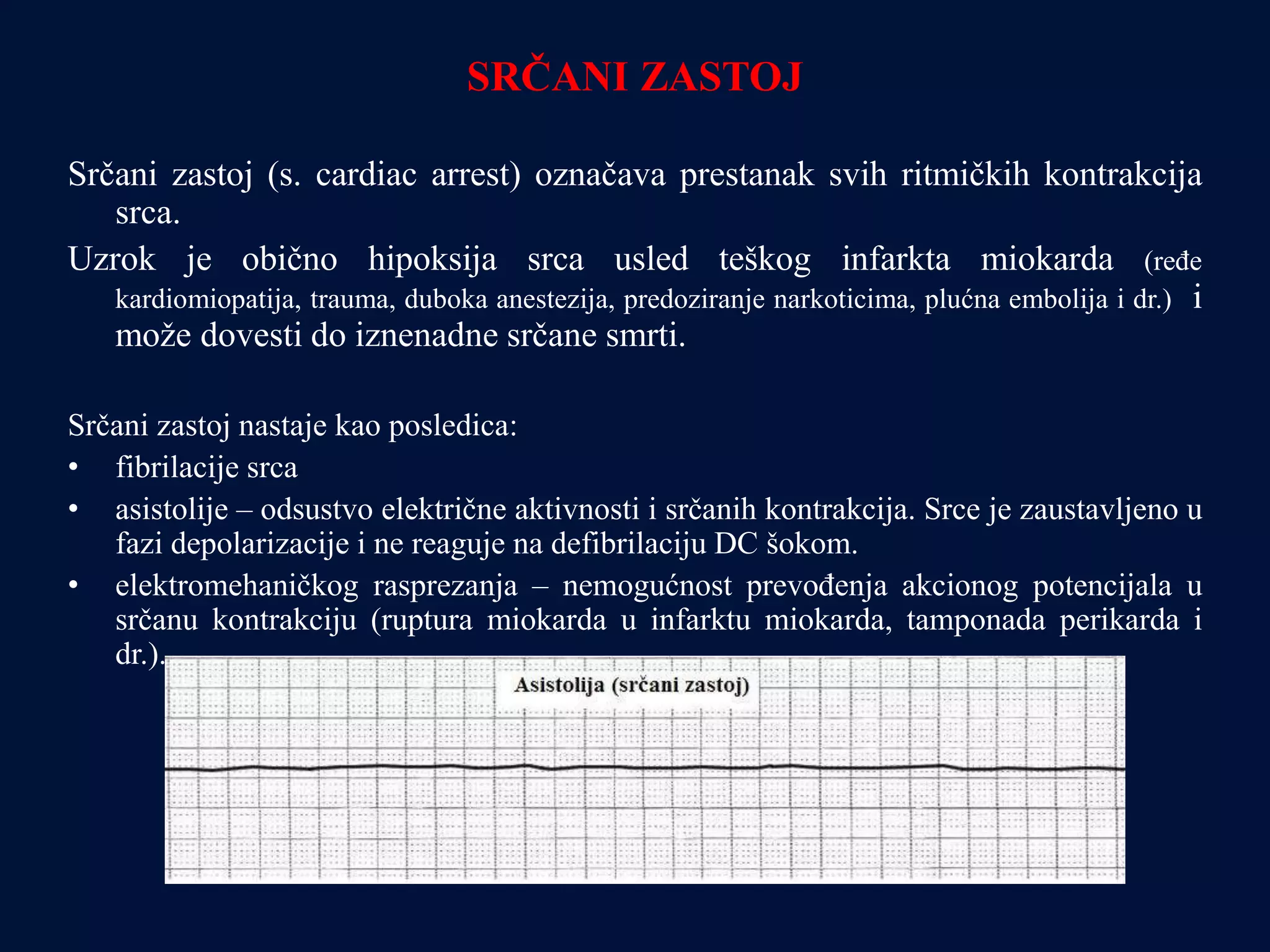 POREMEĆAJI SRČANOG RITMA.ppt