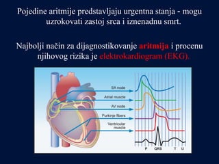 POREMEĆAJI SRČANOG RITMA.ppt