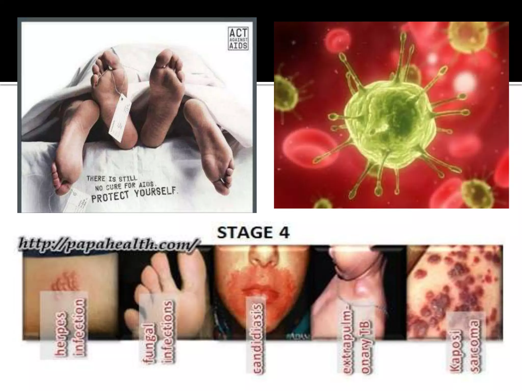 Republic Act 8504: Philippine AIDS Prevention and Control Act of 1998 ...