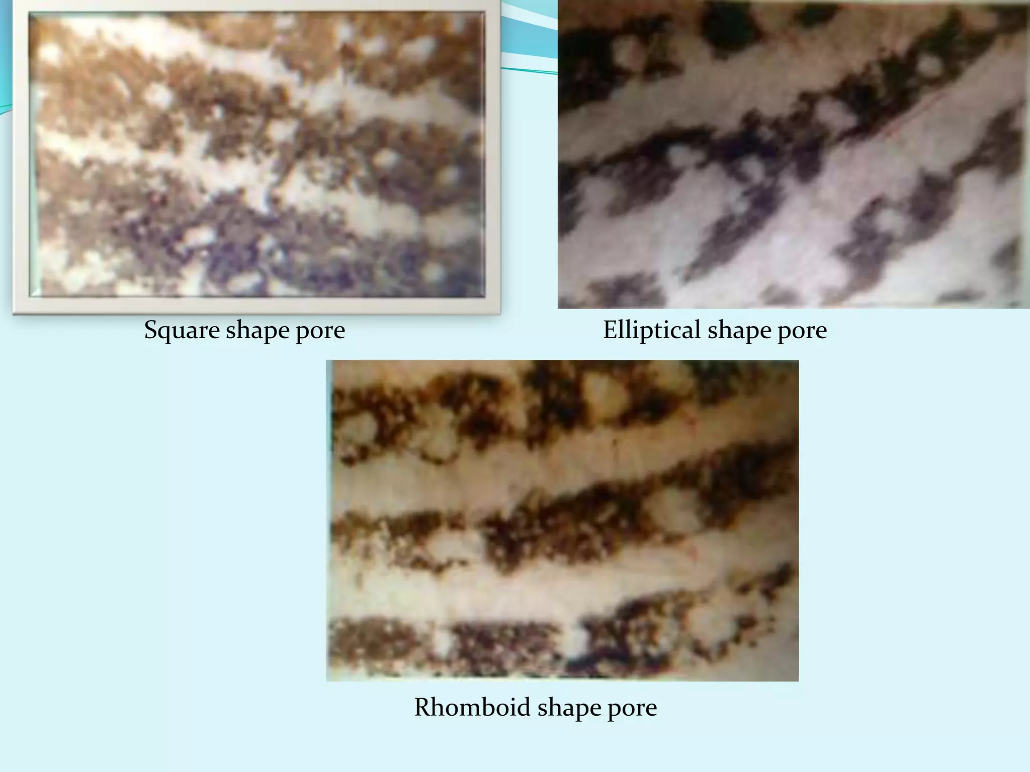 Poroscopy and edgeoscopy | PPTX