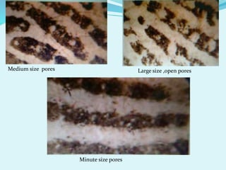 Poroscopy and edgeoscopy | PPTX