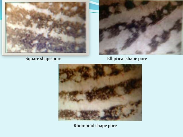Poroscopy and edgeoscopy | PPTX
