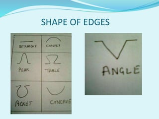 Poroscopy and edgeoscopy | PPTX