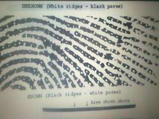 Poroscopy and edgeoscopy | PPTX