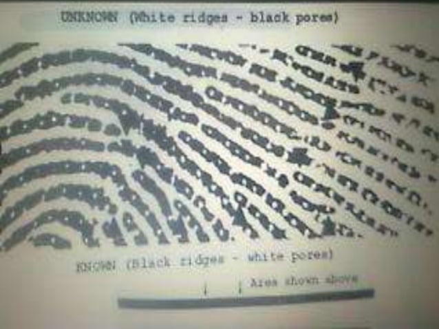 Poroscopy and edgeoscopy | PPTX