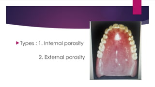 porosity in denture resins,tissue conditioners | PPTX