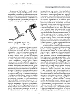 Porownanie wideolaryngoskopow | PDF