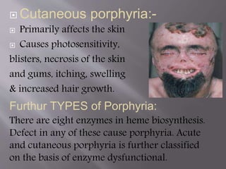 Porphyria | PPTX