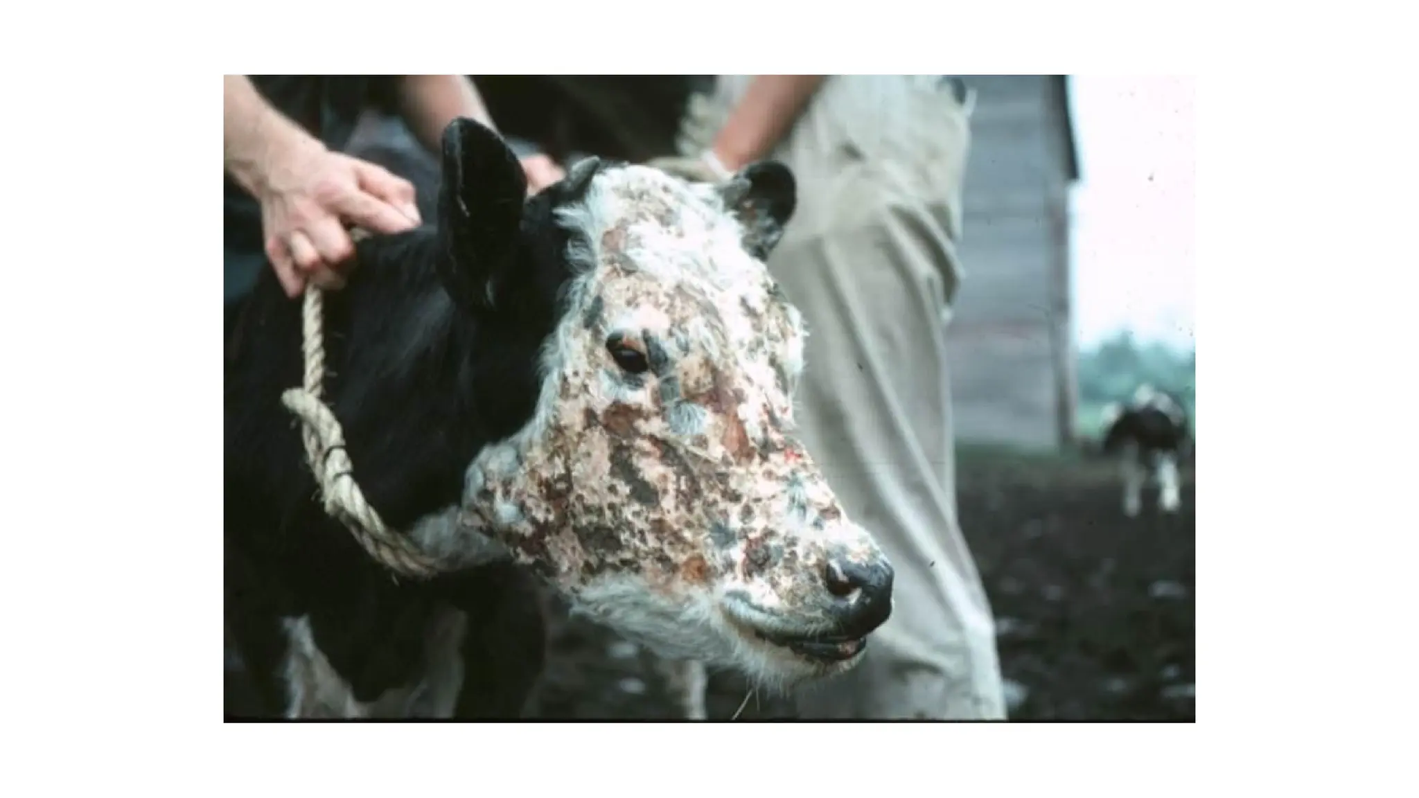 porphyria - Different types, clinical diagnosis | PPTX