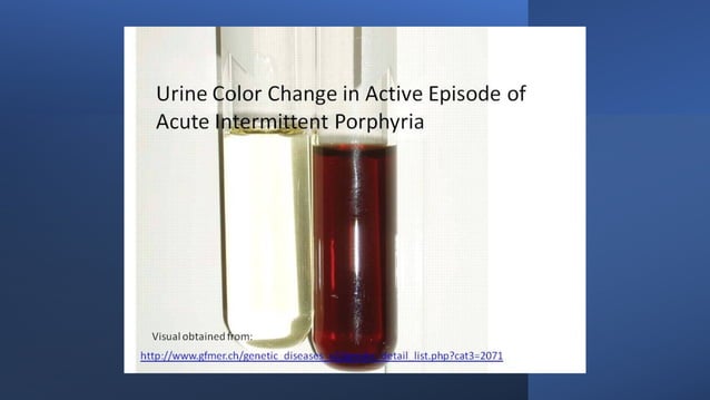 porphyria - Different types, clinical diagnosis | PPT