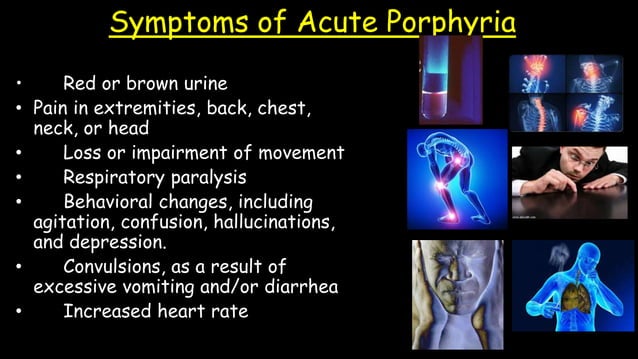 Porphyria - the vampire disease | PPT