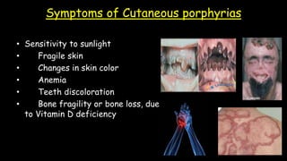 Porphyria - the vampire disease | PPT