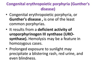 Gunther Porphyria