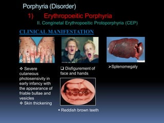 Porpyhrin presentation | PDF | Blood Disorders | Diseases and Conditions