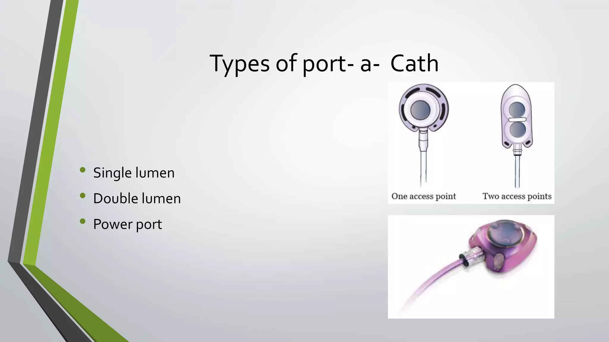 Port a-cath | PPTX