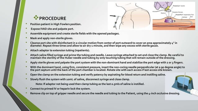 Port a-cath | PPTX