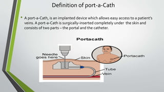 Port a-cath | PPTX