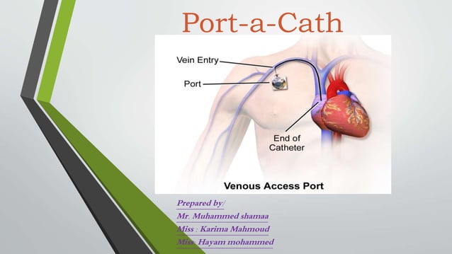 Port a-cath | PPT