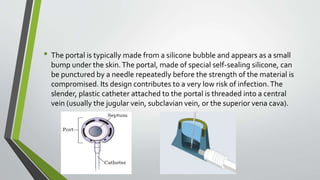 port-a-cath-190315192153 4.pdf
