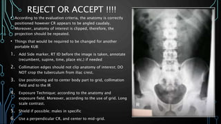 Portable kub | PPTX | First Aid | Injuries