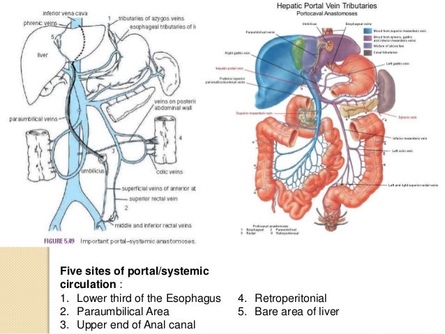 portacaval anastomosis